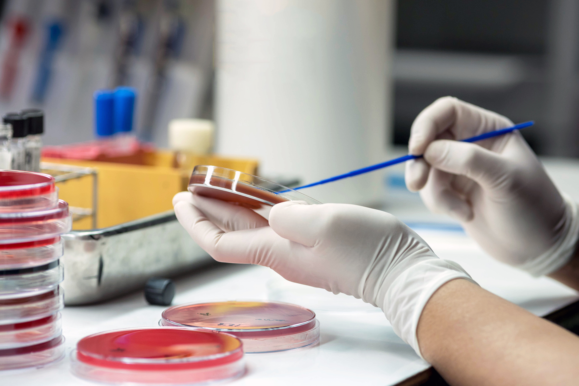 5 Lab Tests Every Nurse Practitioner Should Monitor During Common ...