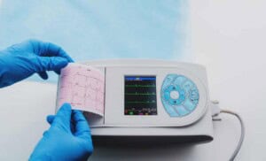 12-Lead ECG for the Point-of-Care Clinician: Mastering the Rapid ...